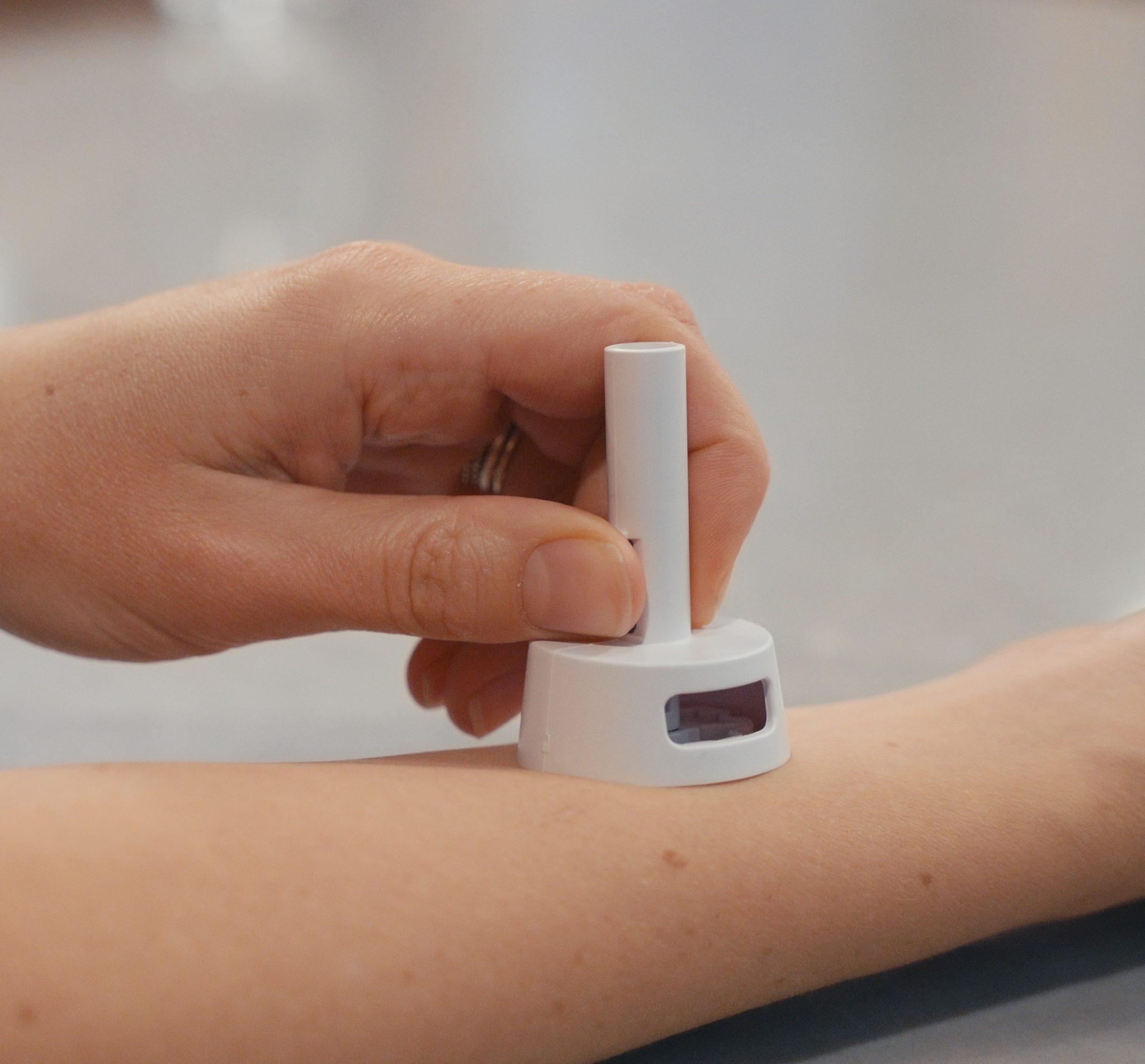 Microneedle Stamp for Peanut Allergy Launches Clinical Trial - Allergic ...